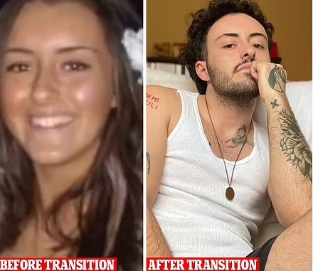 Non-binary people going for “phalgina” surgery to give them both male ...