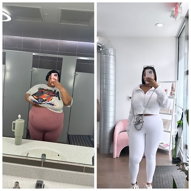 Lady shows off her incredible weight loss transformation - MicroSecondNews
