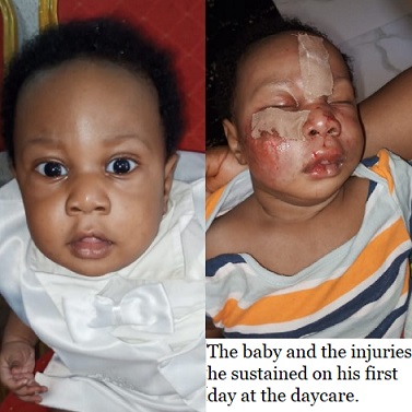 Baby severely injured at daycare in Lagos - MicroSecondNews